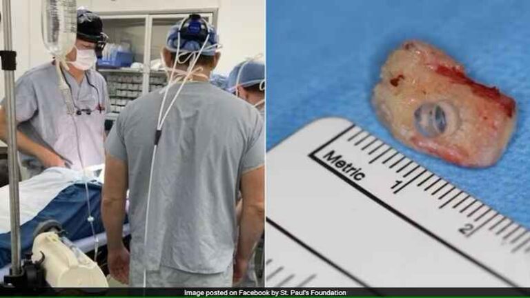 Canadian Doctors Implant Tooth In Blind Woman’s Eye To Restore Vision